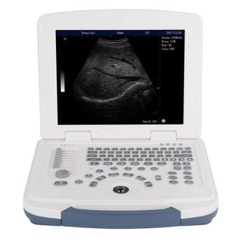 China ON SALE!!!  Portable full digital laptop B&W ultrasound scanner for hospital for sale