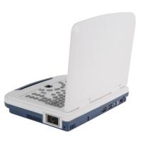 China ON SALE!!!  Portable full digital laptop B&W ultrasound scanner for hospital for sale