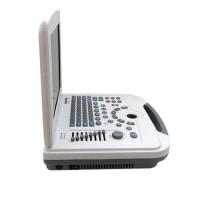 China ON SALE!!!  Portable full digital laptop B&W ultrasound scanner for hospital for sale