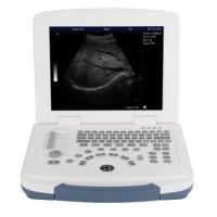 China ON SALE!!!  Portable full digital laptop B&W ultrasound scanner for hospital for sale