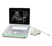 China Portable ultrasound machine Laptop Ultrasound machine SU-7S with CE for sale