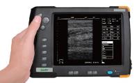 China Palm Ultrasound ScannerSU-V5(ultrasonic,black white,Imaging System) for sale