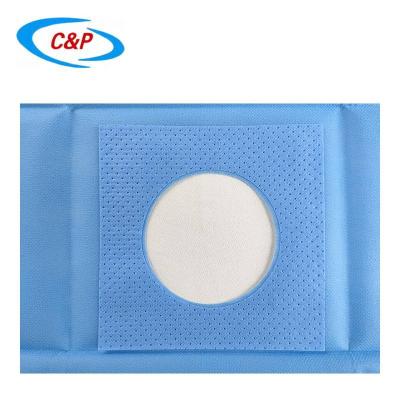 China Waterproof Sterile Disposable Nonwoven Surgical Hole Drape Hospital Surgical Operation Drape for sale
