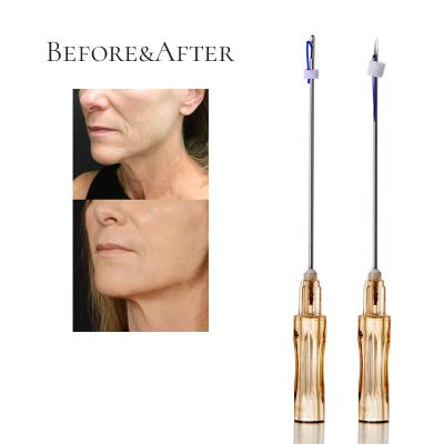 China wholesale anti aging barbed hot sale best medical v line lift cog thread 4d skin suture facial pdo thread with cannula for sale