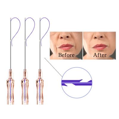 China fine face lifting thread pdo absorbable suture medical equipment PDO molding thread W needle 19g 100mm in china for sale