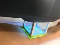 China Lamp Phototherapy Vitiligo Excimer Laser Treatment 308nm Targeted Cure for sale
