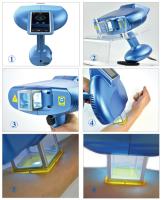 China Homeuse 308NM Excimer System Excimer Laser Vitiligo FDA CE Psoriasis for sale