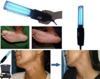 China 311nm Phototherapy Ultraviolet Lamps for sale