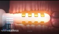 China Peninsula Factory Non Surgical Therapy Vaginal Rejuvenation Radio Frequency For Clinical for sale