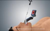 China HD Portable USB Video Laryngoscope Adult Pediatric Reusable Blades 2MP Camera for sale