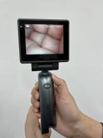 China 3.0 Inch HD Display Medical Video Laryngoscope 3 Million Pixels Intubation Scope for sale