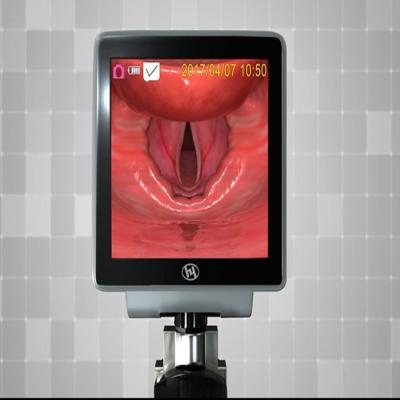 China HAIYE Capnomed Anesthesia Video Laryngoscope Neonatal 225g 3 Inch LCD 32GB for sale