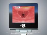 China Portable 3 Inch LCD Video Laryngoscope 1280x720px 32GB Rechargeable for Intubation for sale