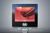 China CE FDA ISO13485 Reusable Video Laryngoscope 3-100mm Depth 3 Inch Screen for sale