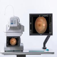 China 60Hz Automatic Fundu Dual Camera System Intellegent Operation for sale