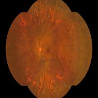 China 220v Power Supply Widefield Fundus Camera with Wide Field 176° Tolerance View for sale