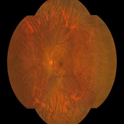 China 220v Power Supply Widefield Fundus Camera with Wide Field 176° Tolerance View for sale