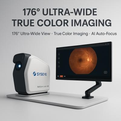China 176° Wide Field Fundus Camera with LED True Color and Automatic Operation for High-Definition Retinal Imaging for sale