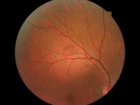 China Non Mydriatic Fundus Camera with ±25D Diopter Compensation 9-position Mosaic Function for sale