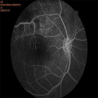 China High Resolution Automated Fundus Camera with FFA or FAF, mosaic function for sale