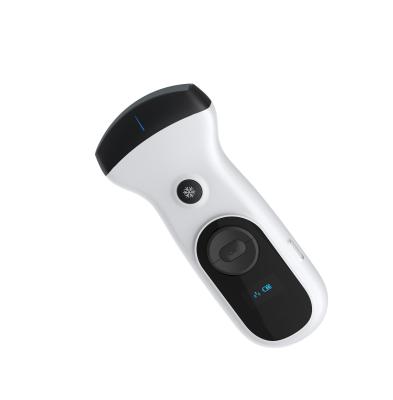 China 2025 Best Handheld Ultrasound | NMPA Approved with HD Frame Rate for sale