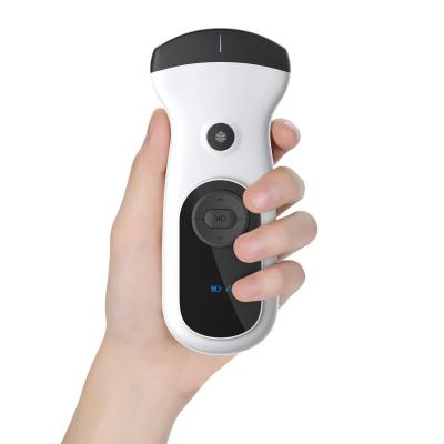 China LUSONIC Portable Ultrasound Device for B/C Mode and Spectral Doppler Aesthetic Medicine Equipment with Full HD Resolution for sale