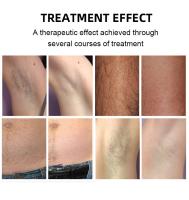 China 808nm Laser Hair Removal Machine With Sapphire Contact Cooling Water Cooling for sale
