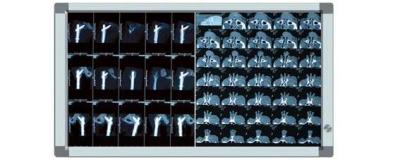 China LED X-ray Viewer STT-4000 Series with 4000cd/m² Brightness and 21mm Ultra-Thin Design for sale