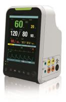 China STT-601A Multi-parameter Patient Monitor with 1.7-inch Display, 400 NIBP Data Storage & 96-Hour Trend Tracking for sale