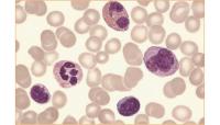 China Liu's Haematocyte Stain Kit For Classification Of Hematocytes for sale