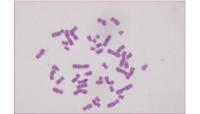 China 1vial*100ml Giemsa Stain For Cytology Widely Used Medical Devices for sale