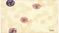 China Neutrophilic- Leukocyte Alkaline Phosphatase Stain for sale