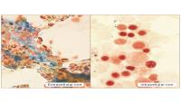 China 5Tests 20Tests 100Tests Iron Stain Kit For Staining Bone Marrow Cell And Bloodcell Smear for sale