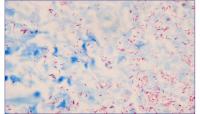 China TB Stain Fluorescence Method 1BTx250ml For For Medical Identification for sale