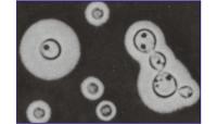 China India Ink Cryptococcus Neoformans Stain Kit 1vialx10ml ISO Certified for sale
