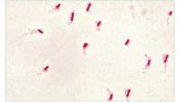 China Flagella Stain Baso Clear Colourful Stains for Healthcare Facility for sale