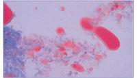 China Advanced Lipid Oil Red O Staining Kit Solvents For Healthcare Facility for sale