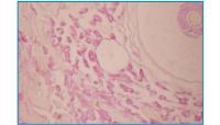 China Mast Cell Stain (Aldehyde fuchsin-OG6 staining method) for sale
