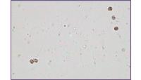China 20Tests Semen Leukocytes Peroxidase Stain Kit Toluidine Method for sale