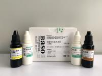 China Acid Fast Fluorescence Chromogenic Reagent Phenol Free 20Test 100Test 200Test for sale