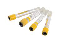 China 5ml 6ml 7ml 8ml Gel And Clot Activator Yellow Serum Separator Clot Activator Tube for sale