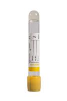 China 5ml 6ml 7ml 8ml Gel And Clot Activator Yellow Serum Separator Clot Activator Tube for sale