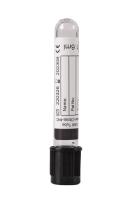 China Black Vacuum Blood Test Tube Prevents Premature Clotting with 1 4 Ratio Anticoagulant in Black for sale