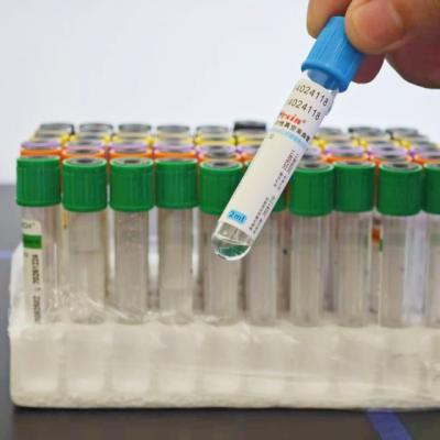 China PT Tube Vacuum Blood Test Tube 6ml 7ml Automated Ammonia Blood Collection Tube for sale