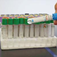 China PT Tube Vacuum Blood Test Tube 6ml 7ml Automated Ammonia Blood Collection Tube for sale