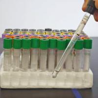 China Erythrocyte Sedimentation Rate Vacuum Blood Test Tube Black Top Tube Anticoagulant for sale