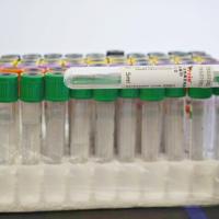 China Automatic Labeling Machine for 13x75mm 13x100mm Blood Test Tubes for sale
