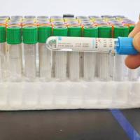 China Sodium Citrate 1:9 Clot Activator Tube Tube Glucose  Coagulation Test Tube for sale