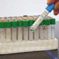 China Sodium Citrate 1:9 Clot Activator Tube Tube Glucose  Coagulation Test Tube for sale