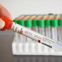 China ORSIN Medical Clot Activator Blood Collection Tube Green Top Blood Tube 100mm for sale